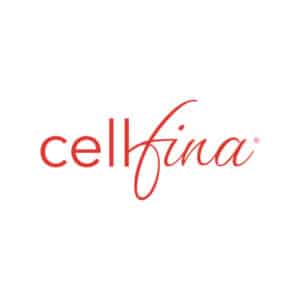 San Diego Cellulite Treatment Before and After Photos