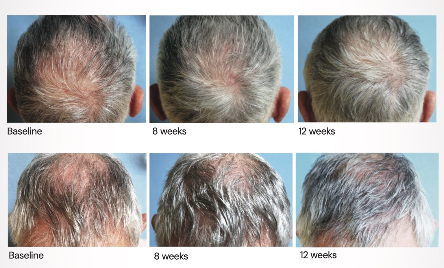 Exosome Innovation Meets Evidence-Based Beauty: Invo Aesthetics at Art ...